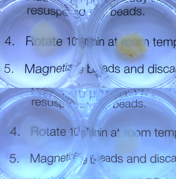 Structural microvascular changes associated with cerebral amyloid ...